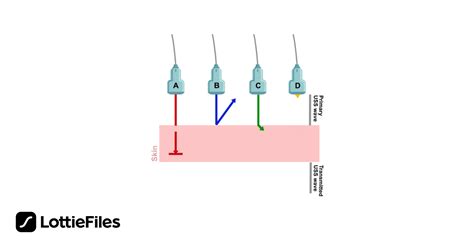 Free Interaction With Tissue Ultrasound Basics Animation By Joana Barreira Lottiefiles