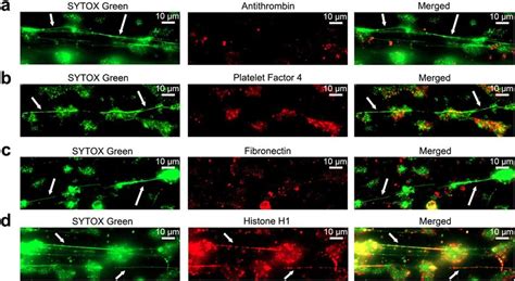 Sytox Positive Polymers Contain Histones But Not Antithrombin