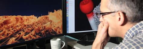 Computer Simulations Of Fracture Fixations In Osteoporotic Bones Cscs