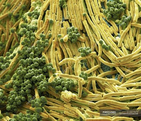 Coloured Scanning Electron Micrograph Of Bacteria Cultured From Mobile Phone — Prokaryotic