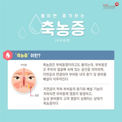 국민건강보험 축농증 이라고도 부르는 부비동염 은 코 주위 얼굴뼈 속에 있는 공간인 부비동 점막의