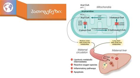 ორსულთა ცხიმოვანი ჰეპატოზი