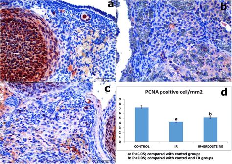 Pcna Staining A Control Group B Ischemia Reperfusion Group