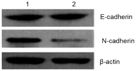 The Expression Of E Cadherin And N Cadherin After The Intervention 1 Download Scientific