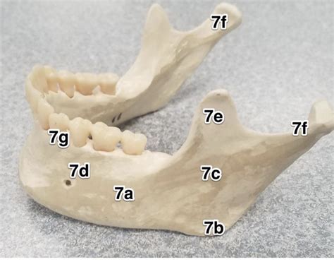 Mandible Diagram Quizlet