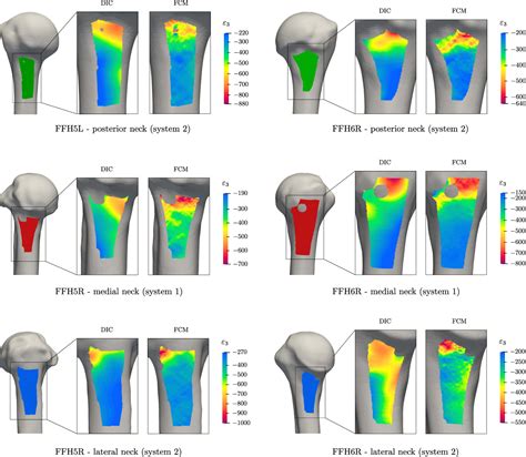figure 8 from predicting fracture in the proximal humerus using phase