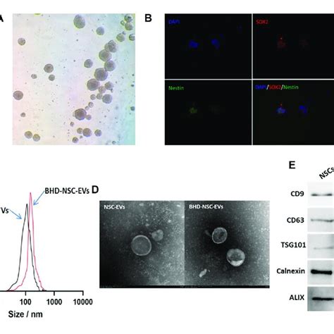 Identification Of Primary Neural Stem Cell And Extracellular Vesicles Download Scientific
