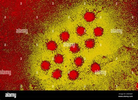 False Colour Transmission Electron Micrograph Tem Of Virions Of The Hepatitis A Virus