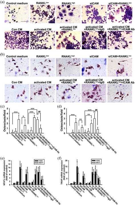 Soluble Icam 1 In Cancer Cell Conditioned Medium Promote Download