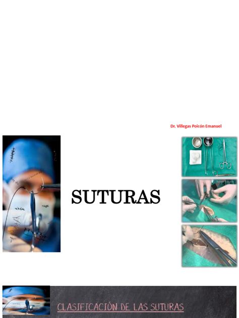 Tipos De Suturas Quirúrgicas Y Técnicas Pdf