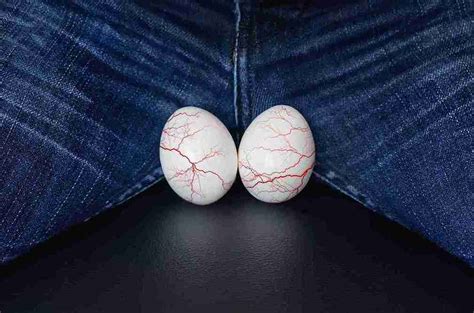 Testicular Atrophy Treatment Options