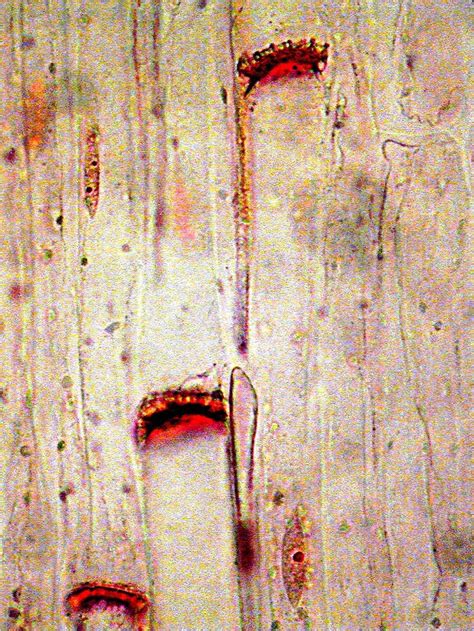 Phloem Longitudinal Section