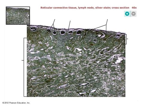 Reticular Connective Tissues Lymph Node Silver Stain Cross Section