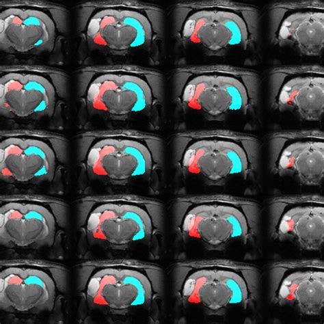 segmentation maps in 4 representative slices from a randomly selected