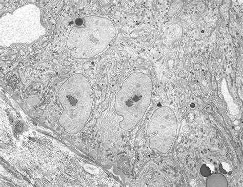 Human Testis Tem Stock Image C055 3586 Science Photo Library