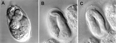 Differential Interference Contrast Micrographs Of Emb 9 Mutant Embryos