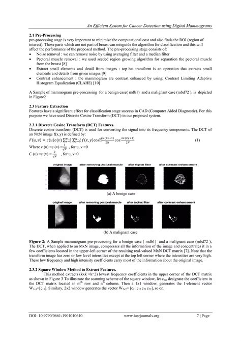 An Efficient System For Cancer Detection Using Digital Mammograms Pdf