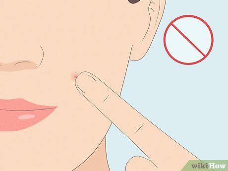 What To Do After Removing A Pimple Patch A Complete Guide
