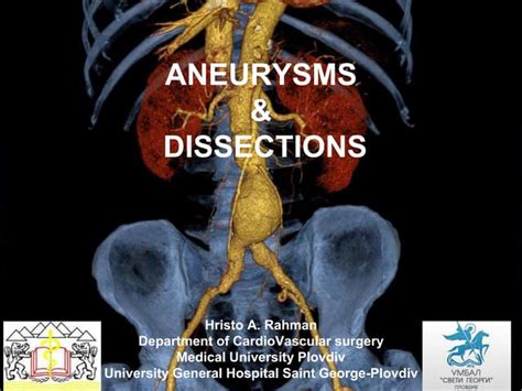 Aneurysms And Dissections Pptx