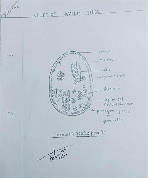 Fasciola Hepaticasporocyst And Redia Larva Comment Diagram Permanent