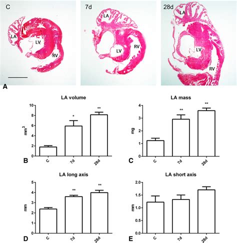 Left Atrial Remodeling Following Nonreperfused Myocardial Infarction