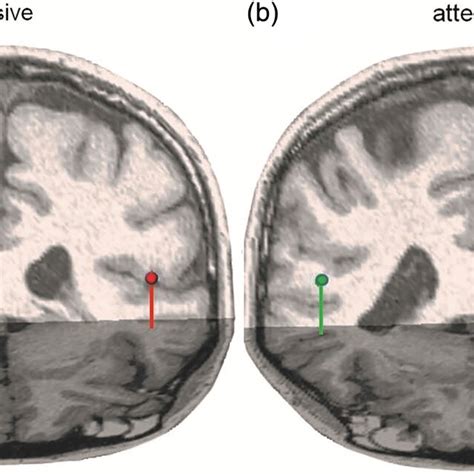 Estimated Cortical Dynamics Of The Gating Generators In The Primary Download Scientific Diagram