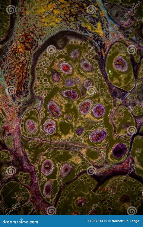 Echinococcus Parasitic Liver Fluke Stock Image Image Of Cells Bunt