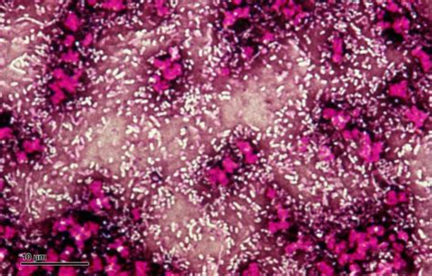 Eubacteria 19 Fun Facts About These Fascinating Microorganisms