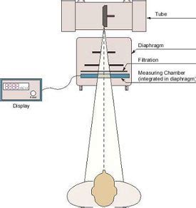 VELTCAMP Dose Area Product DAP