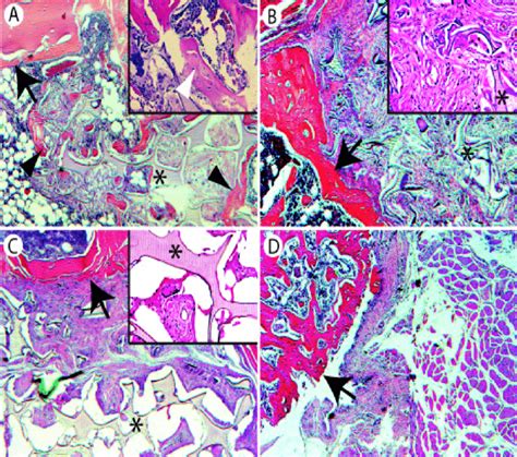 Histological Cross Sections Taken From Rat Critical Size Femoral Download Scientific Diagram