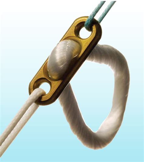 Endo Button With Loop Bond Well Ortho