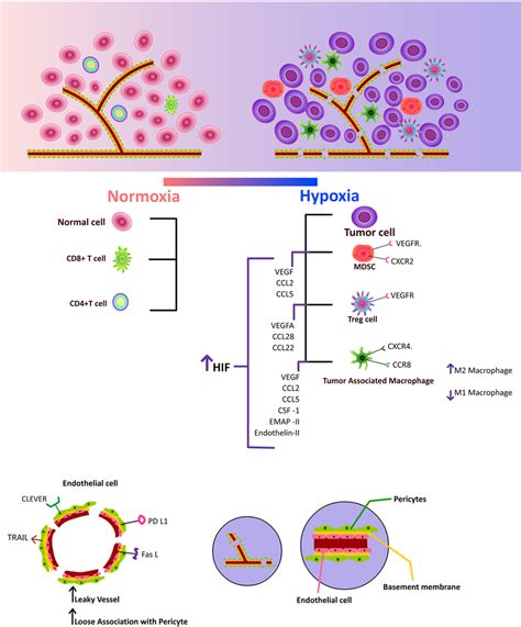 Increased Hypoxia Inducible Factor Which Upregulates Pro Angiogenic