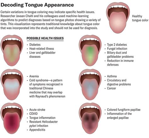Ai Reads Your Tongue Color To Reveal Hidden Diseases Digital Biology Lab