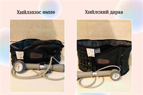 Нурууны үе хоорондын шингэн шимэгдэх нурууны суулттай болох мэдрэл