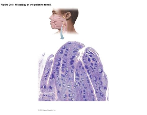 Pharyngeal Tonsils Histology Labeled