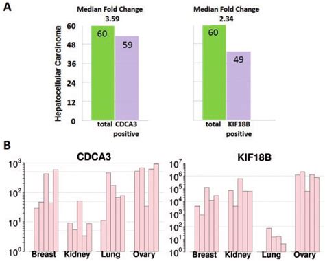 A Results Of Cdca3 And Kif18b Gene Expression Analysis From The Icod