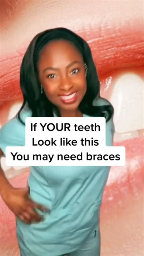 If Your Teeth Look Like This You May Need Braces Braces Tips Sensitive Teeth Healthy Teeth