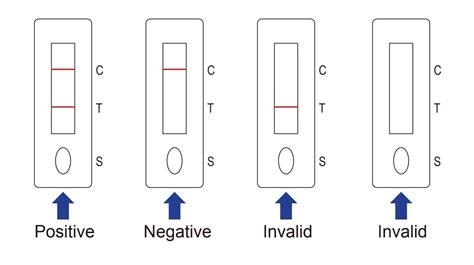 Sars Cov 2 Nucleocapsid N Antigen Rapid Detection Kit Colloidal Gold Method — Saliva Test