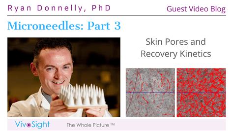 Essential Tools And Techniques To Accelerate Microneedle Array Patch