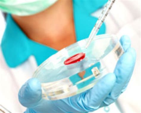 Leucémie Lymphoïde Chronique Les Différents Types De Leucémie Medipedia