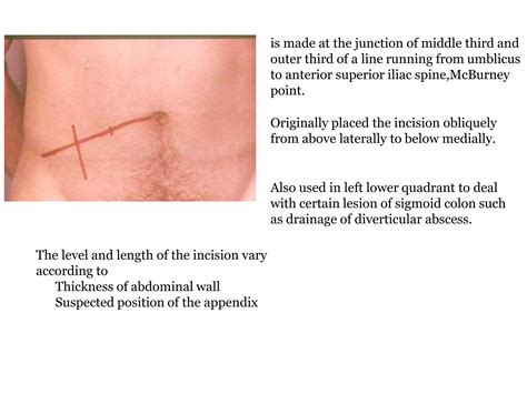 Incision Pptx