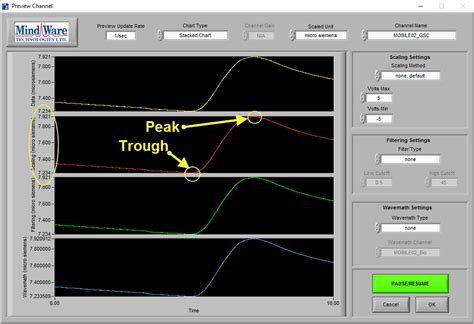 Improving Data Quality EDA MindWare Technologies Support