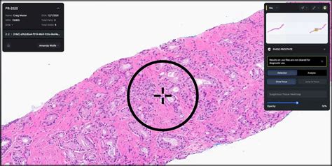 Fda Clears Ai Powered Tool From Paige For Prostate Cancer Dailyalts