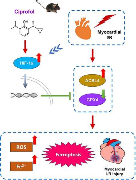 Ciprofol Ameliorates Ferroptosis In Myocardial Ischemia Reperfusion In Dddt