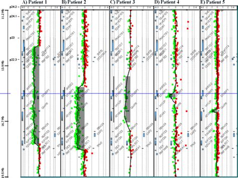 Array Cgh Results In Patients 1 5 A E Revealing Deletions In