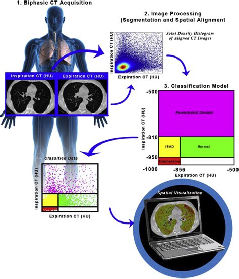 Figure 1 From Parametric Response Mapping As An Indicator Of Bronchiolitis Obliterans Syndrome