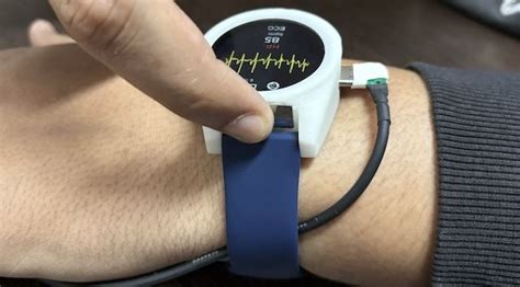 Electrocardiogram Ecg Electronics Lab