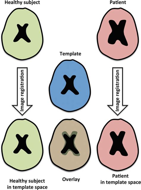DTI Analysis Methods Voxel Based Analysis Radiology Key