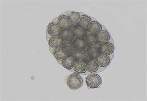 Quia Parasite Identification