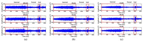 Prediction Of Epileptic Seizures Based On Multivariate Multiscale